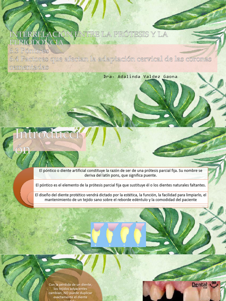 Diseño y Función del Póntico Dental | PDF | Odontología ...