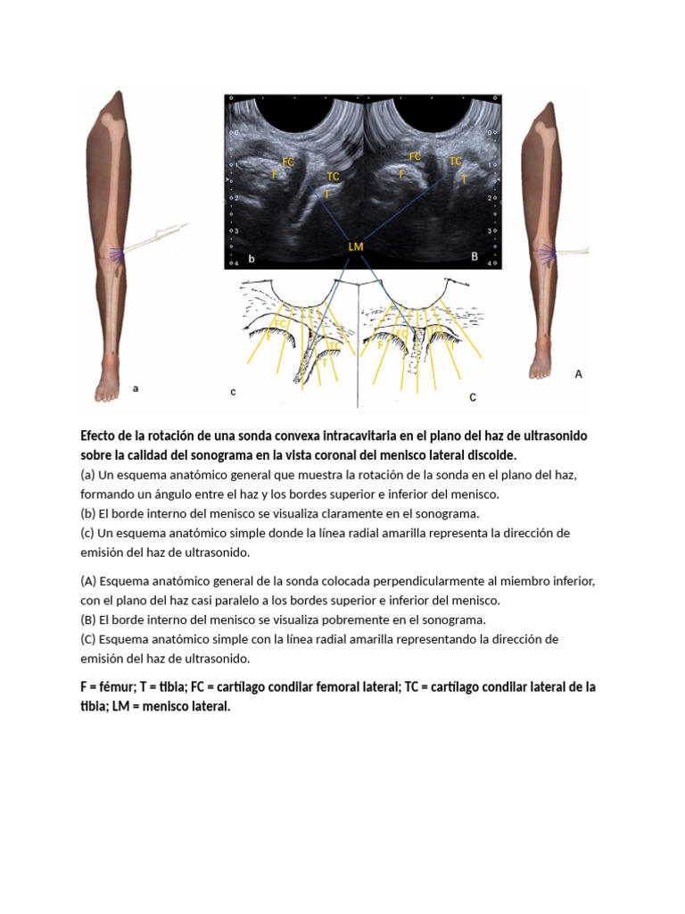 Efecto de La Rotación de Una Sonda Convexa Intracavitaria en El Plano ...