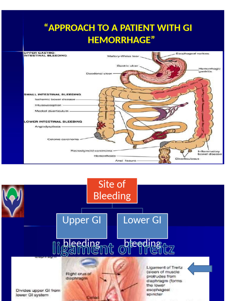 Upper Gi Bleed Approach | PDF | Bleeding | Medical Specialties