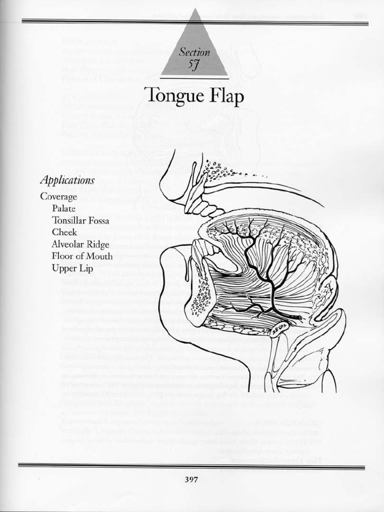 5J - Tongue Flap | PDF