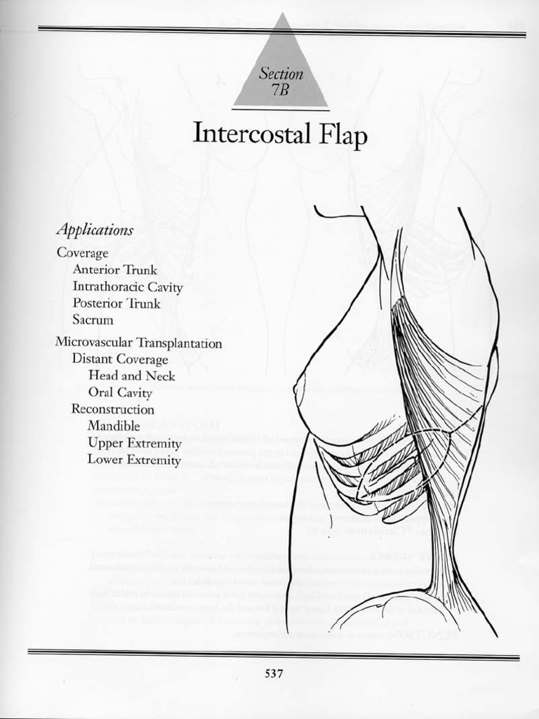 7B - Intercostal Flap | PDF