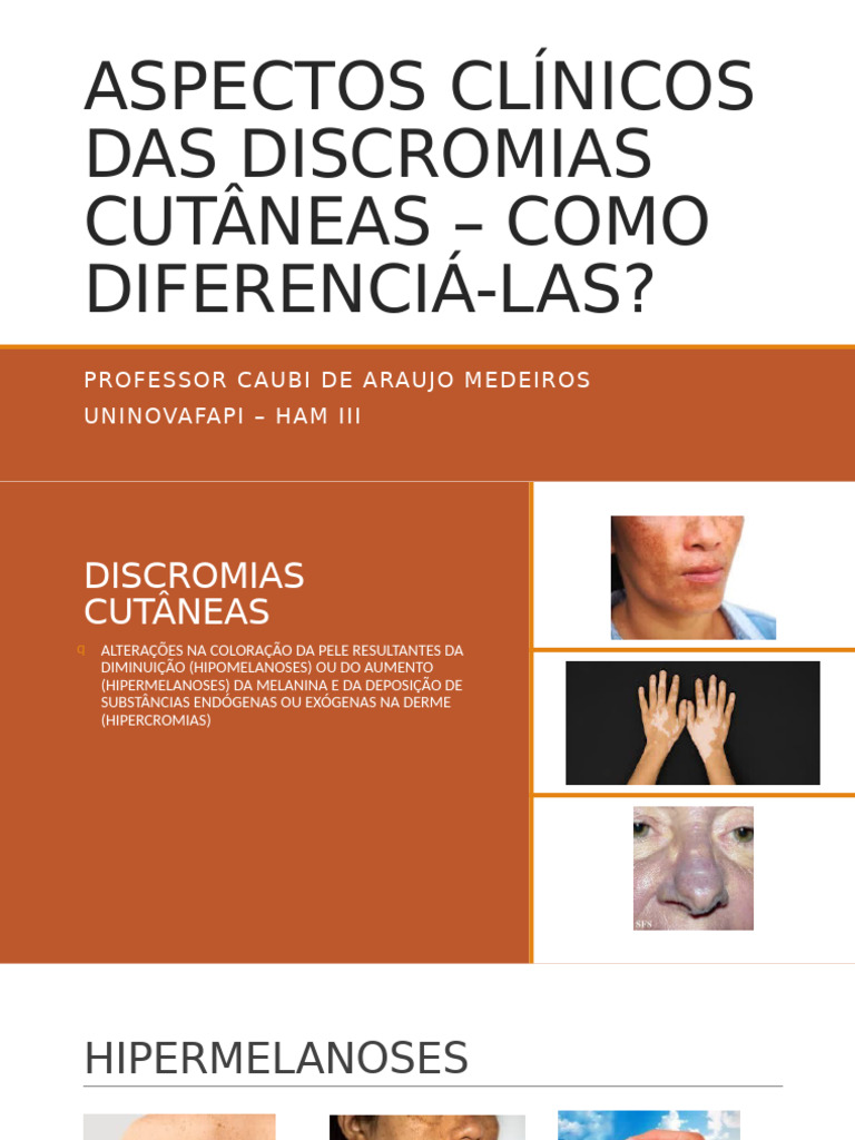 Cópia de AULA TEORICA UNINOVAFAPI - ASPECTOS CLÍNICOS DAS DISCROMIAS ...