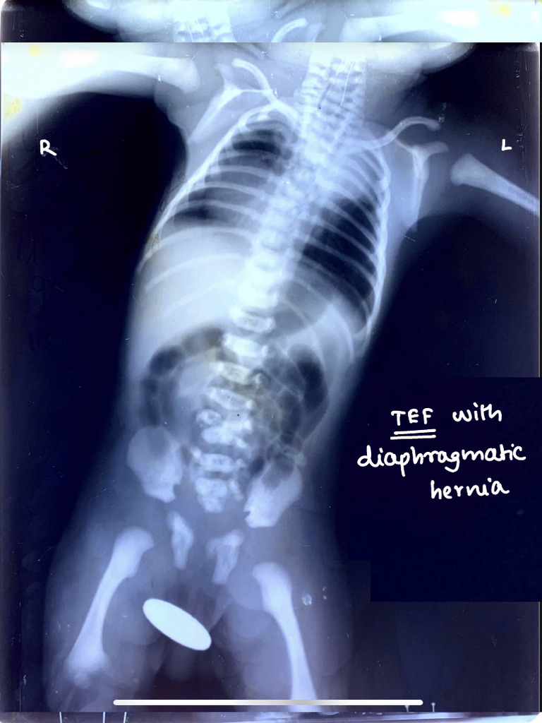 X Rays Pediatrics | PDF