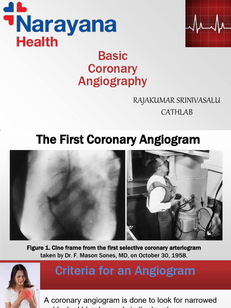 Standard Views in Coronary Angiography | PDF | Coronary Circulation ...