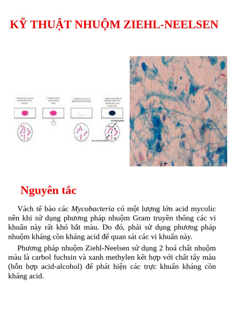 Bài Nhuôm Ziehl Neelsen | PDF