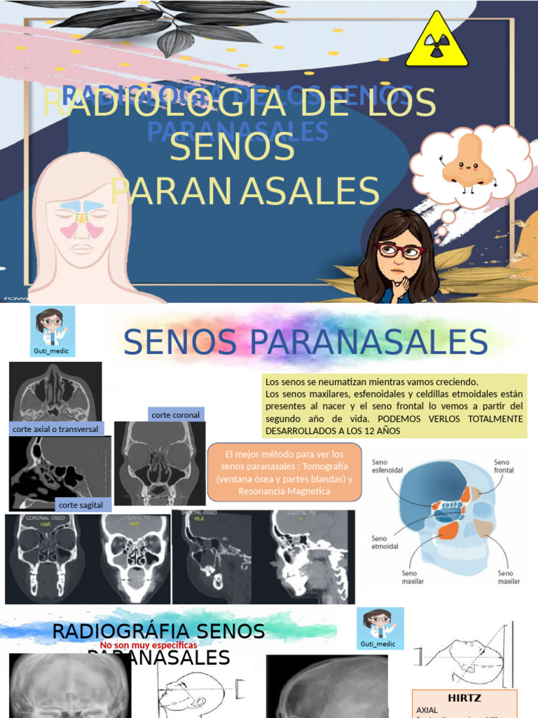 Senos - Paranasales Int Ballivian | PDF | Nariz humana | Imagen
