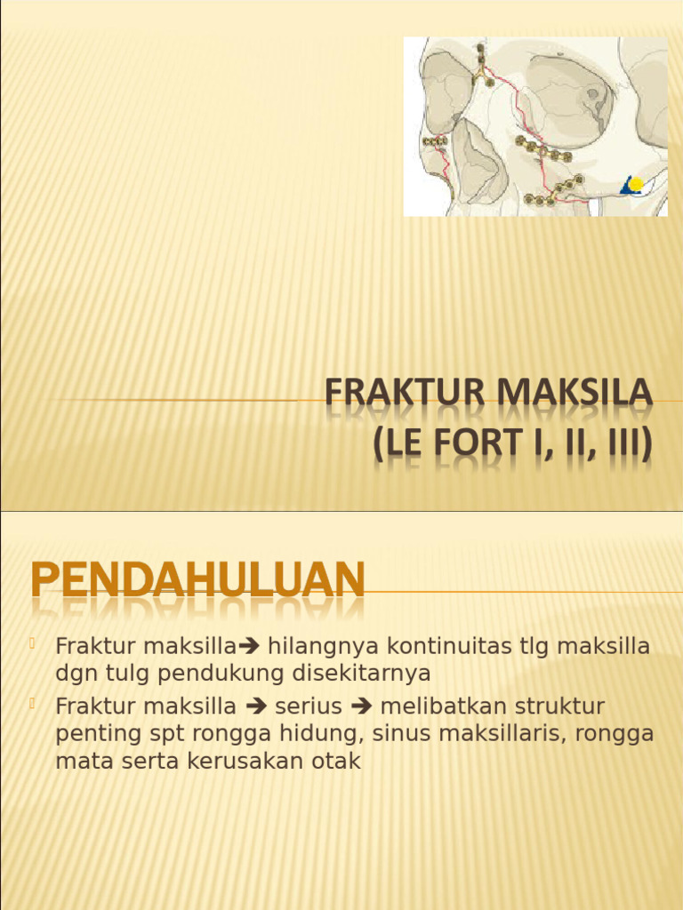 Fraktur Maksila - Nurwahida | PDF