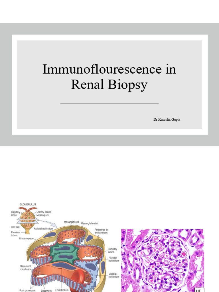 Immunoflourescence in Renal Biopsy | PDF | Immunofluorescence | Kidney Disease
