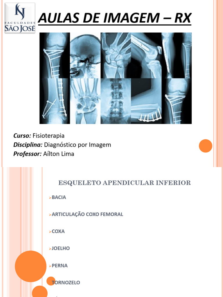3 - Aulas de Imagem - Outra Esq Apend Inf Power | PDF