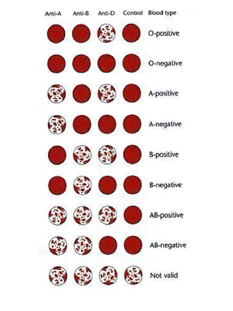 Type of Blood Group | PDF