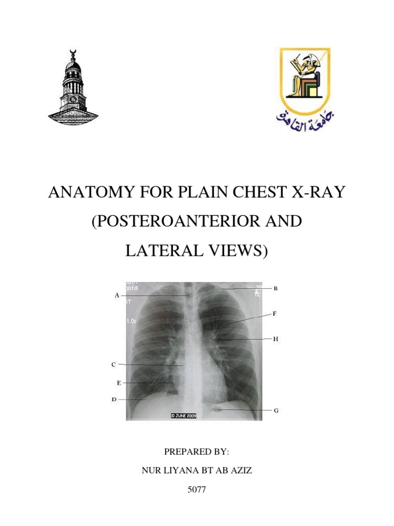 Anatomy For Plain Chest X Ray | PDF | Respiratory Tract | Lung