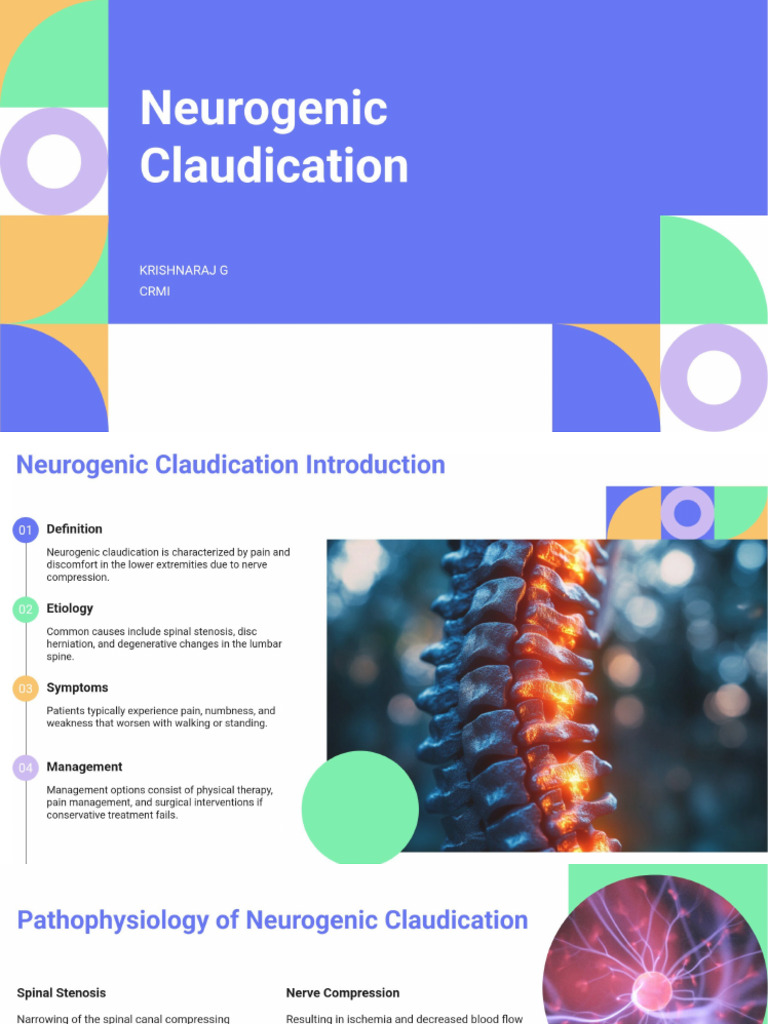 Neurogenic Claudication | PDF