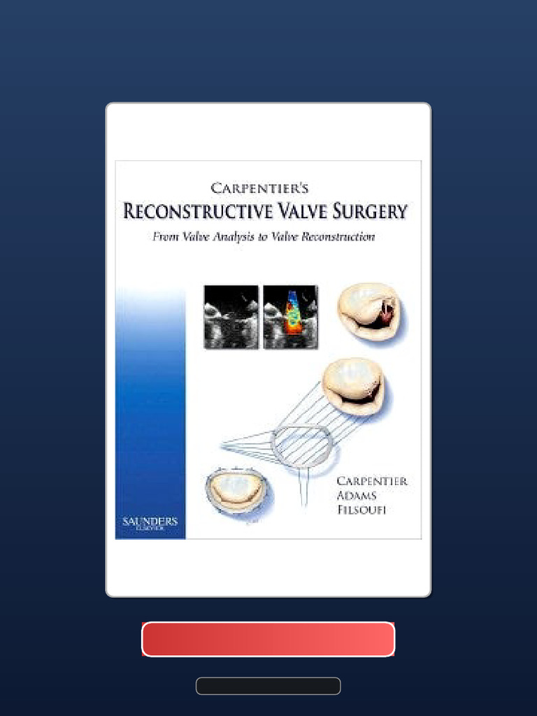 Carpentiers Reconstructive Valve Surgery 1e Official Test Bank | PDF ...