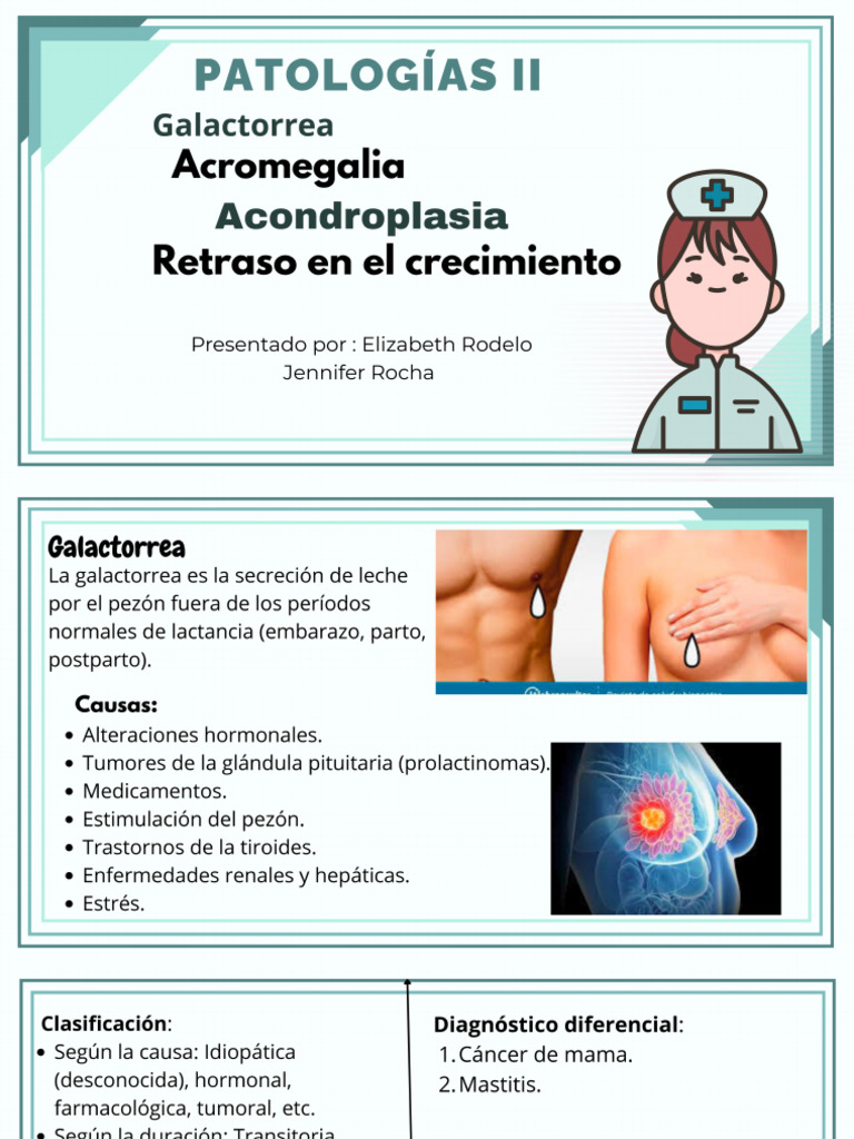 Galactorrea... 20250620 215949 0000 | PDF