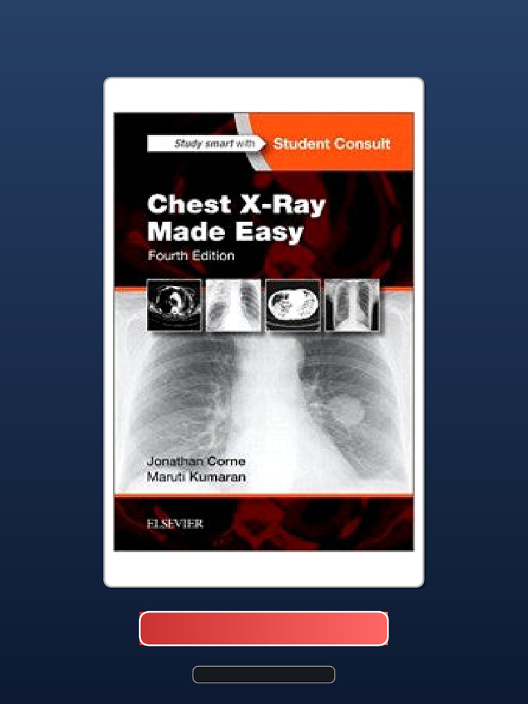 Chest XRay Made Easy 4th Edition Official Test Bank | PDF | Medical ...