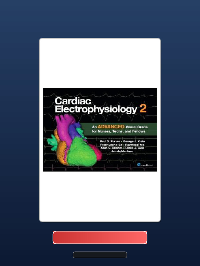 Cardiac Electrophysiology 2 An Advanced Visual Guide For Nurses Techs ...