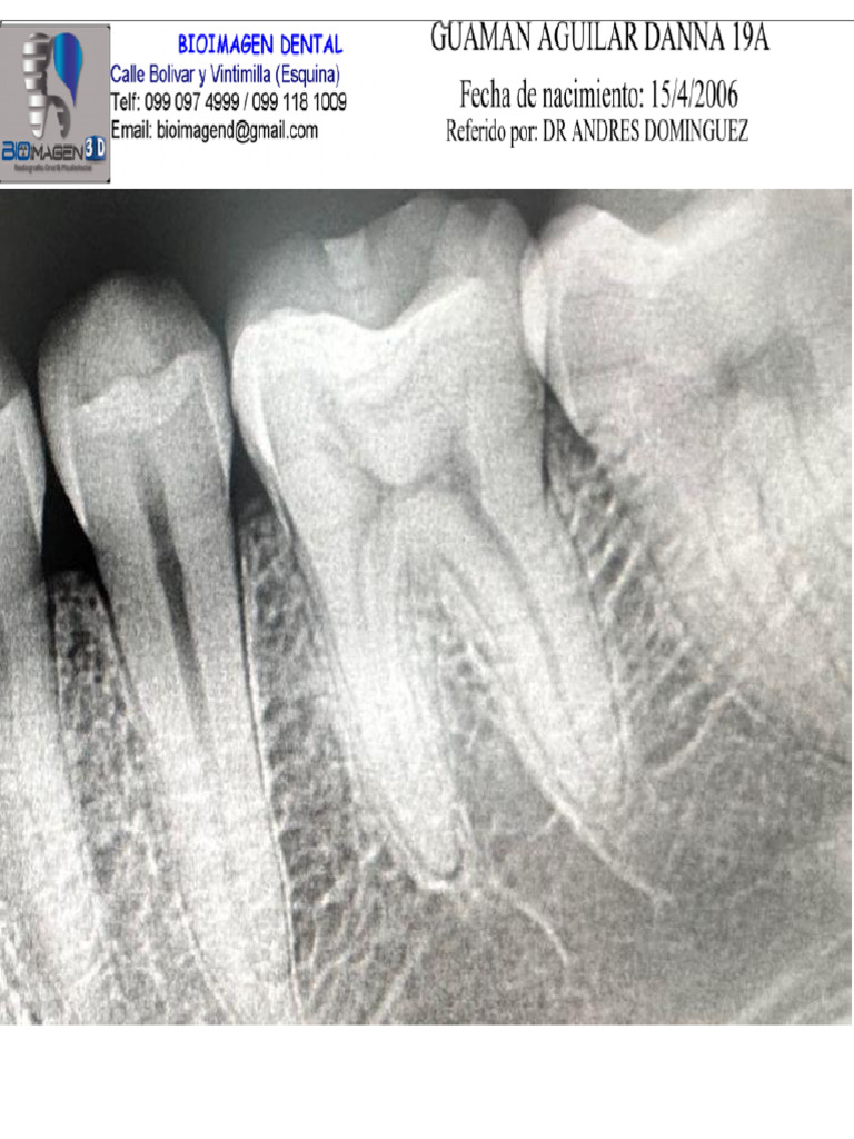 Periapical | PDF