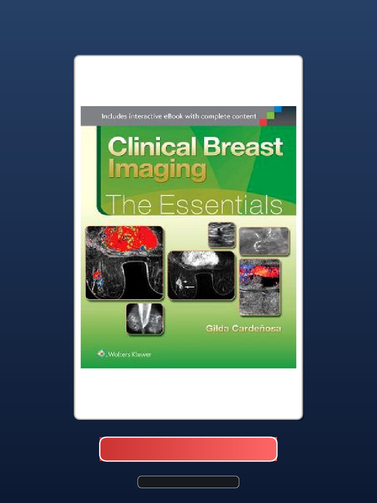 Clinical Breast Imaging The Essentials Official Test Bank | PDF ...