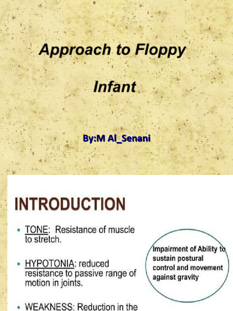 Causes of Floppy Infant Syndrome | PDF