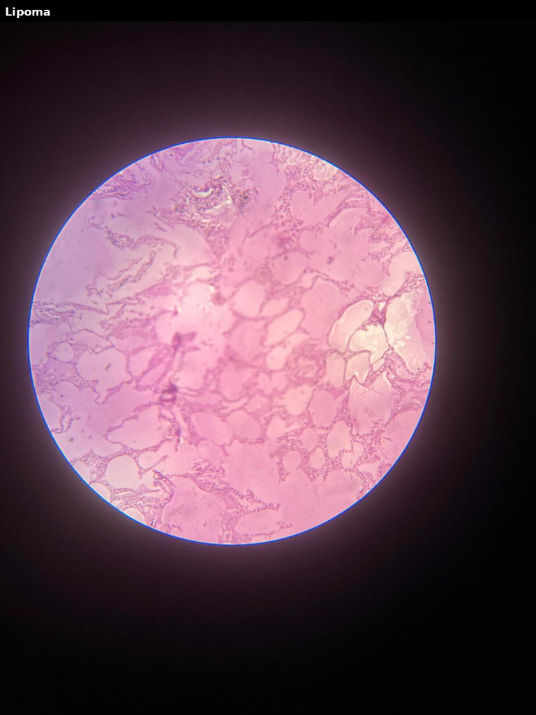 Labeled Histopathology Slides | PDF