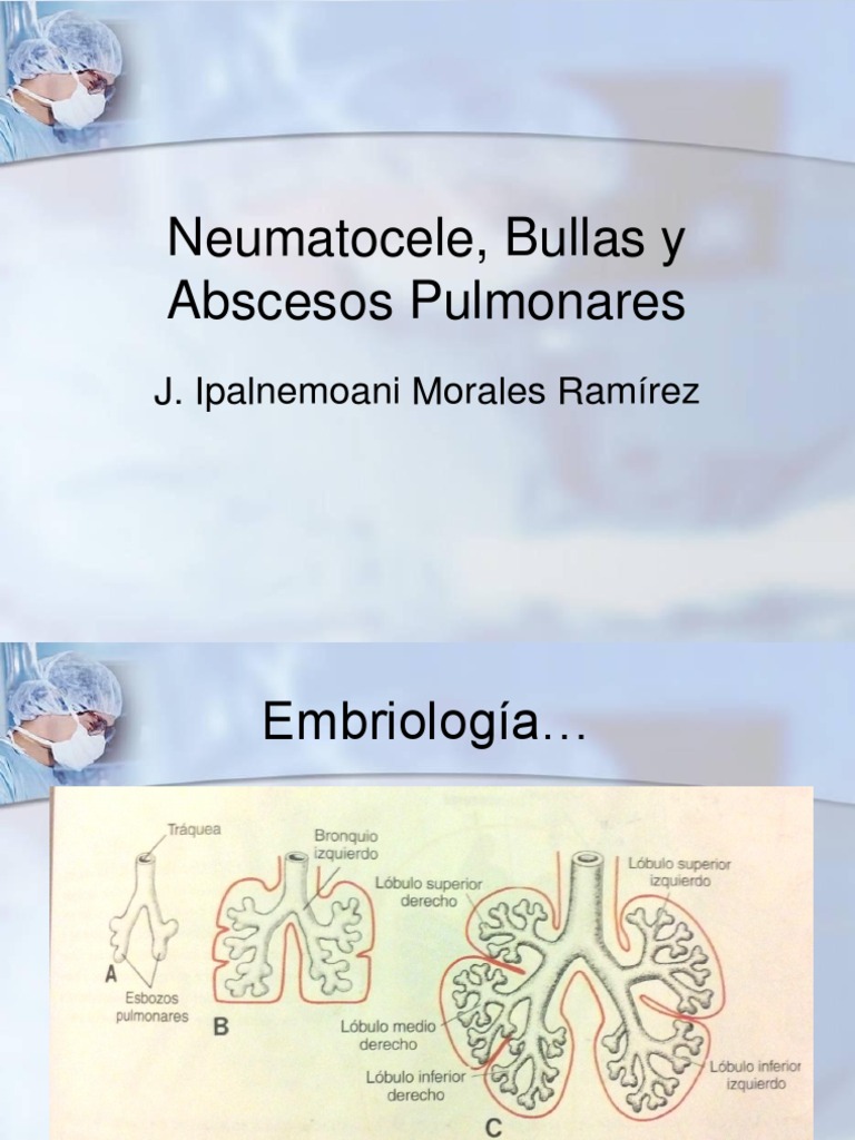 Neumatocele, Bullas y Abscesos Pulmonares | PDF | Enfermedades y ...