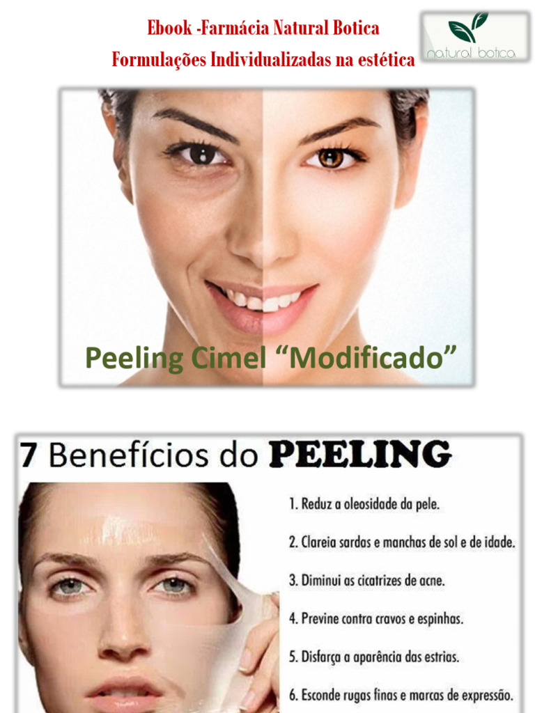 Peeling de Cimel: Inovação Estética | PDF | Pele | Sistema tegumentar