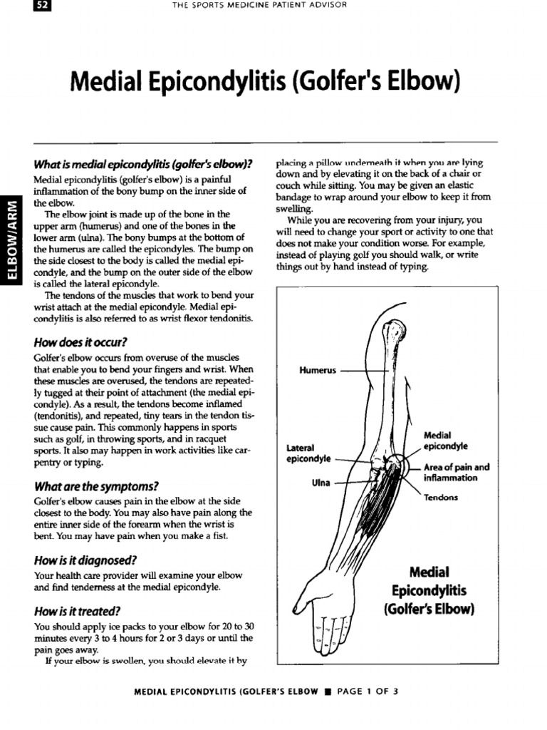Elbow Medial Epicondylitis Tennis Elbow | PDF