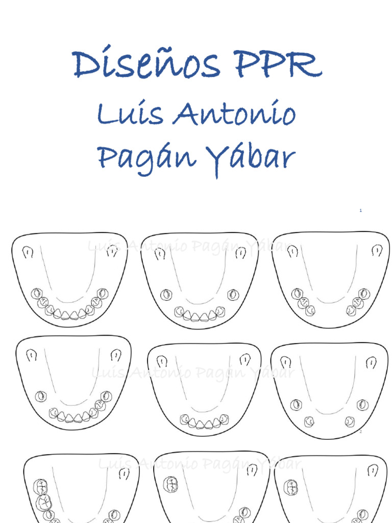 Diseños y Modificaciones PPR | PDF