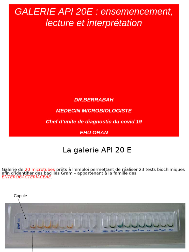 Lecture et Interprétation de la Galerie API 20E | PDF
