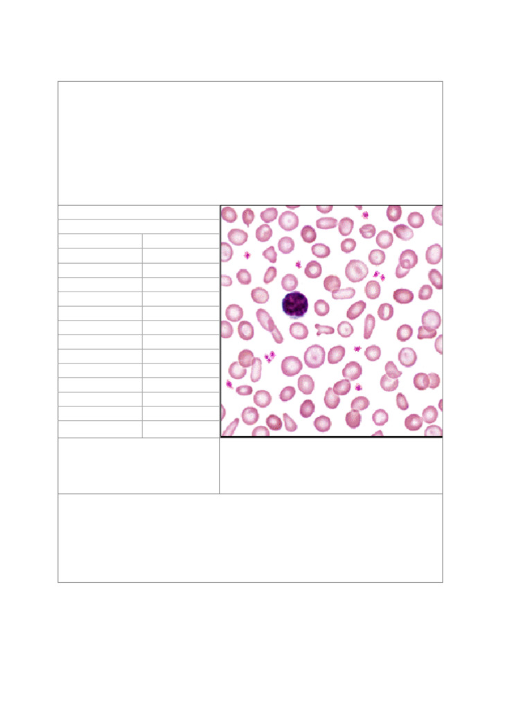 Case Based Learning 2 and 3 | PDF | Anemia | Hematology
