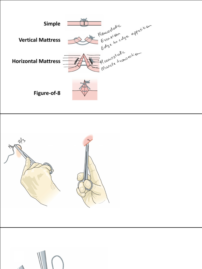 16-Basic Surgical Skills - Suturing and Knotting (New) Atf | PDF