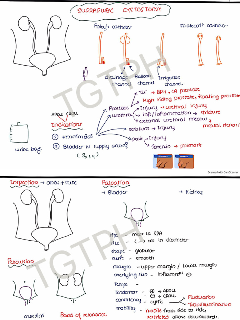 SPC Tube Examination Handwritten Notes | PDF