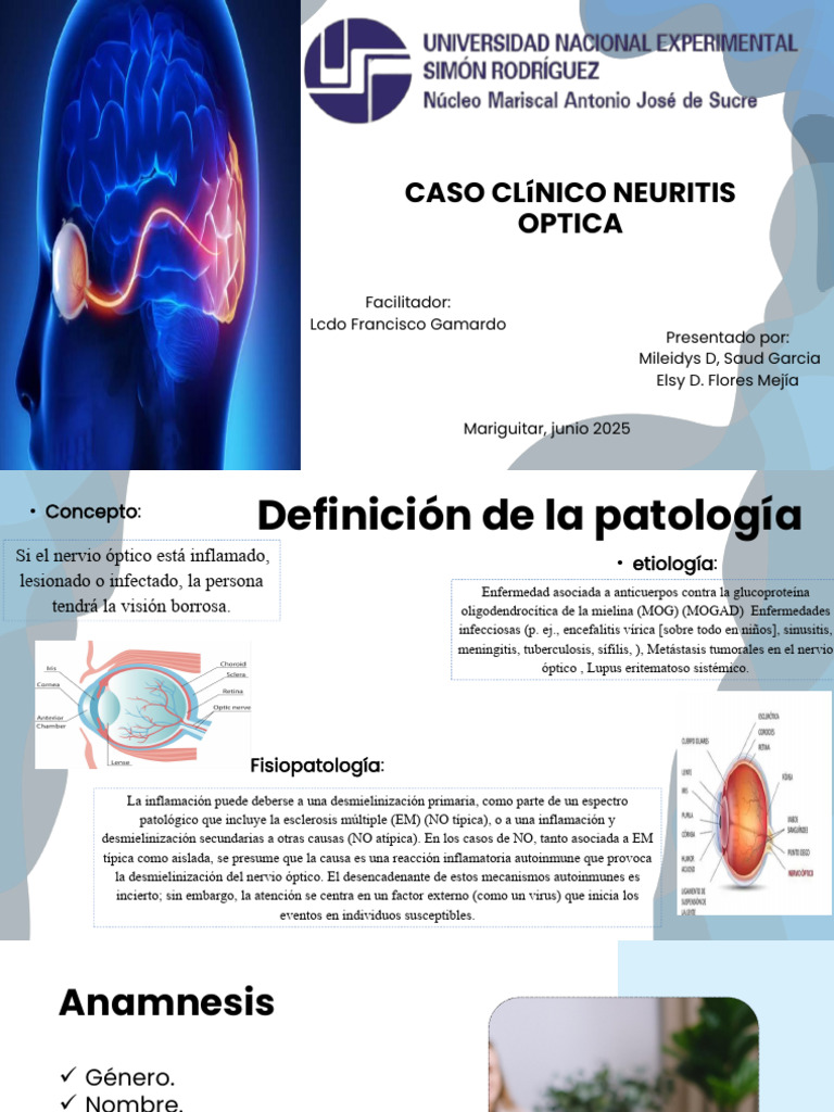 Neuritis Óptica: Caso Clínico y Tratamiento | PDF | Percepción visual ...