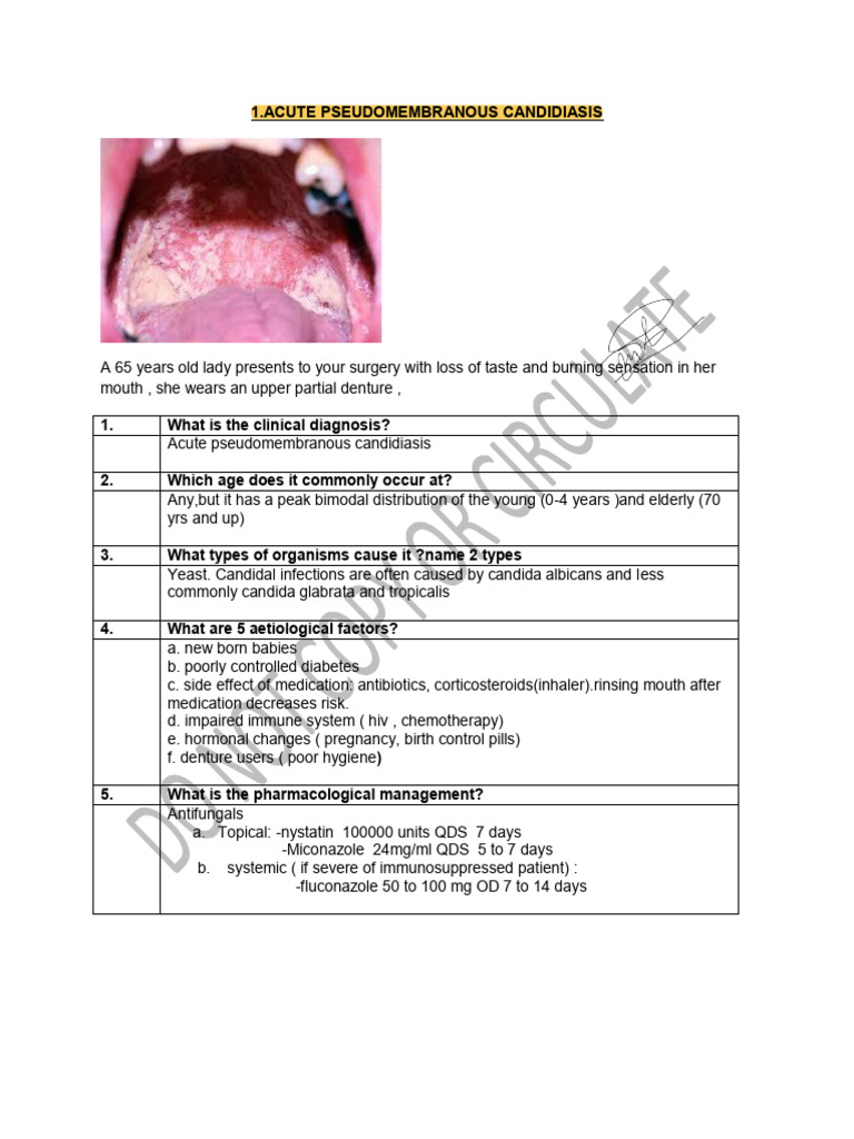 All Written Osces Signed | PDF | Candidiasis | Dentures