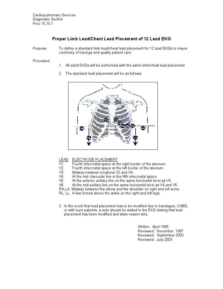 12 Lead EKG Placement | PDF