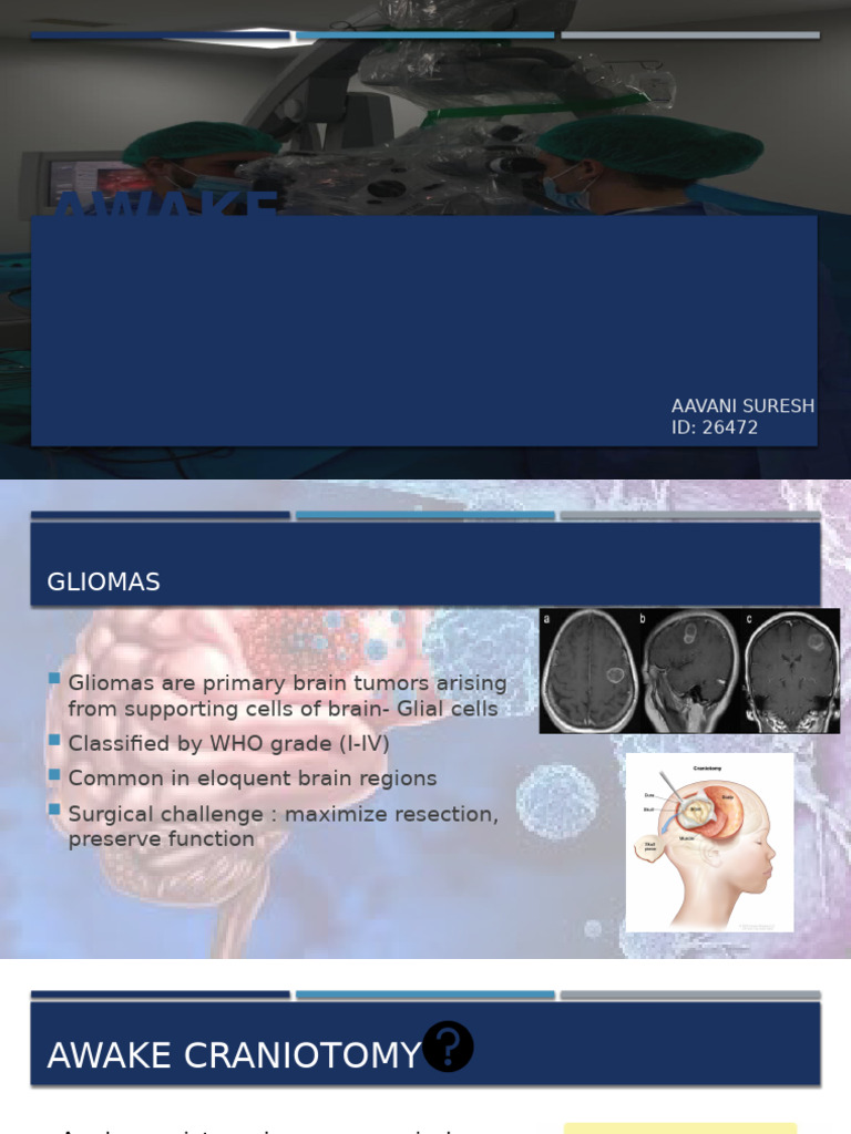 Awake Craniotomy for Glioma Surgery | PDF | Brain Tumor | Neuroscience