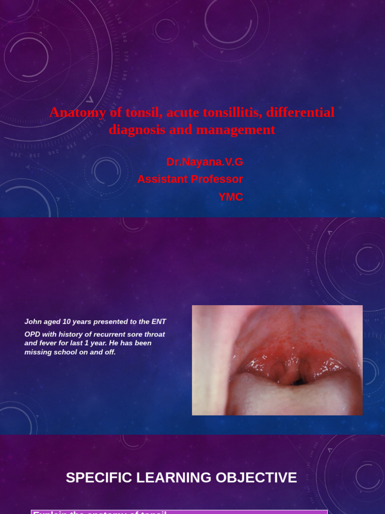 Acute Tonsillitis: Anatomy and Management | PDF | Lymph Node | Medical ...