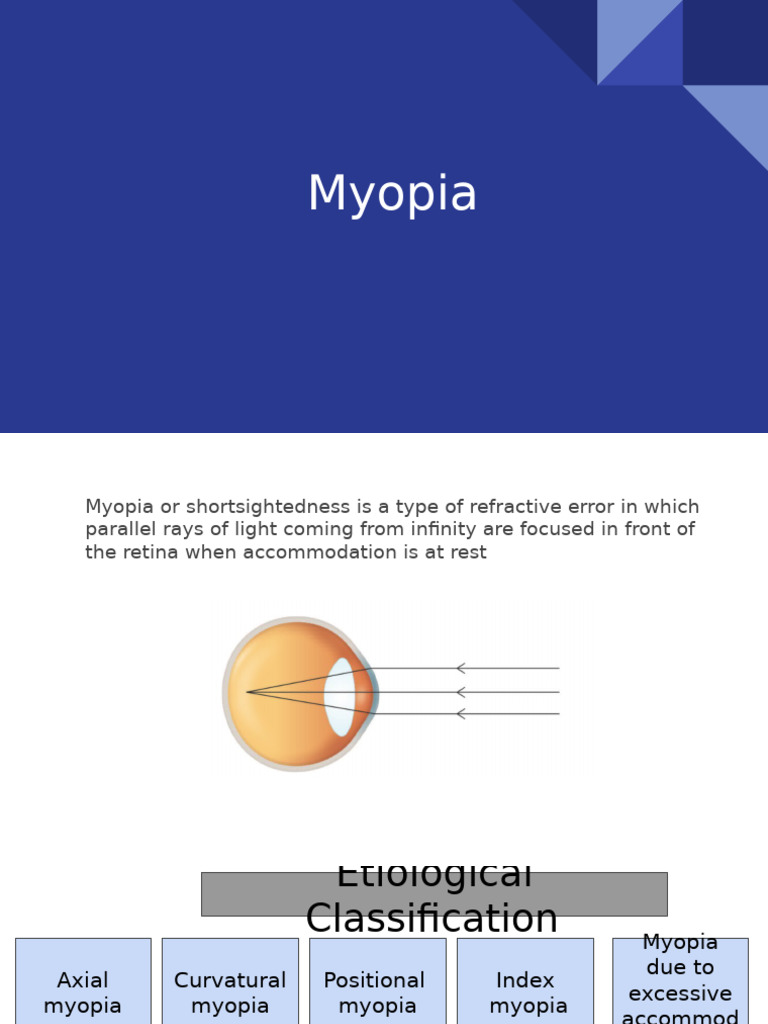 Myopia or Near Sightedness | PDF