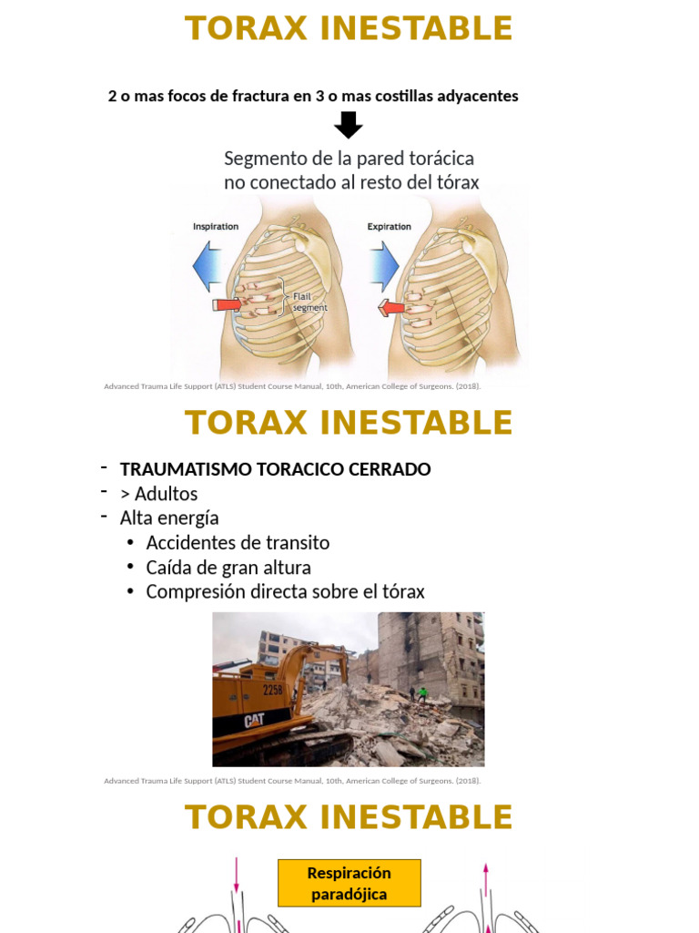 10.2 Trauma Torácico | PDF | Tórax | Medicina CLINICA