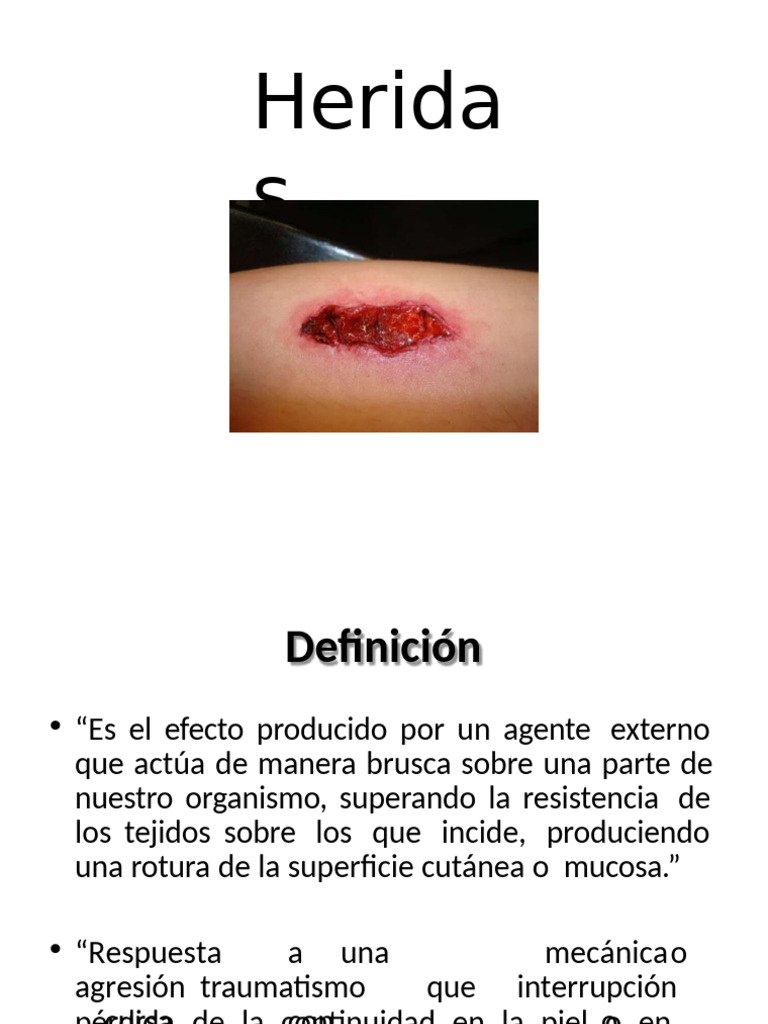 Heridas e Infiltración Anestésica Lab | PDF | Herida | Especialidades Medicas