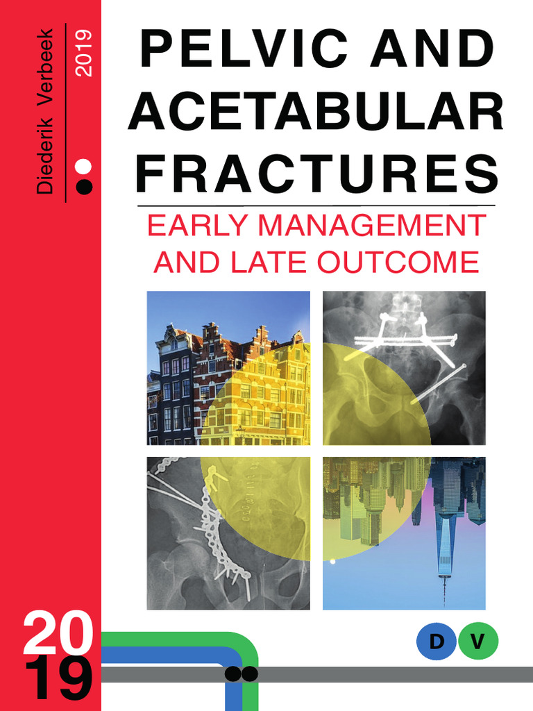 Pelvic and Acetabular Fractures | PDF | Major Trauma | Ct Scan