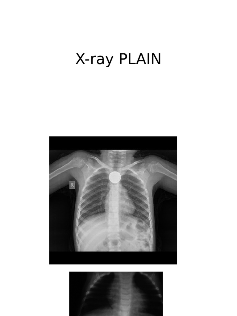 Xrays Plain | PDF