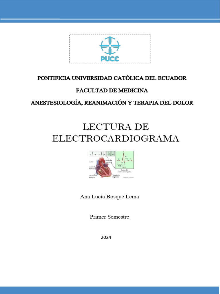 Lectura de EKG PASO A PASO | PDF | Enfermedades cardiovasculares ...
