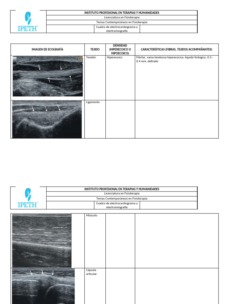Cuadro de Ecograf A y Electromiograf A 1 | PDF