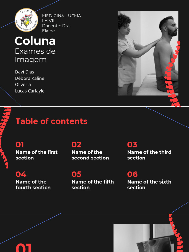 Anatomia e Exames da Coluna Vertebral | PDF | Vértebra | Imagem de ...