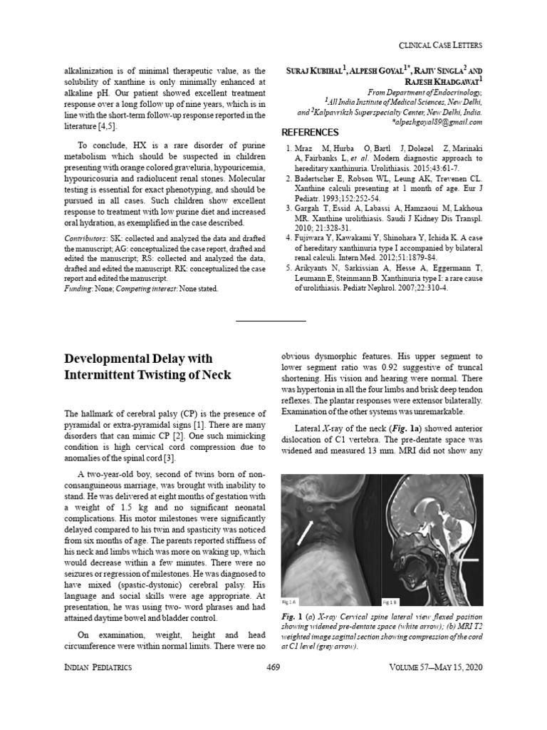 Atlanta Axial Dislocation | PDF | Cerebral Palsy | Clinical Medicine