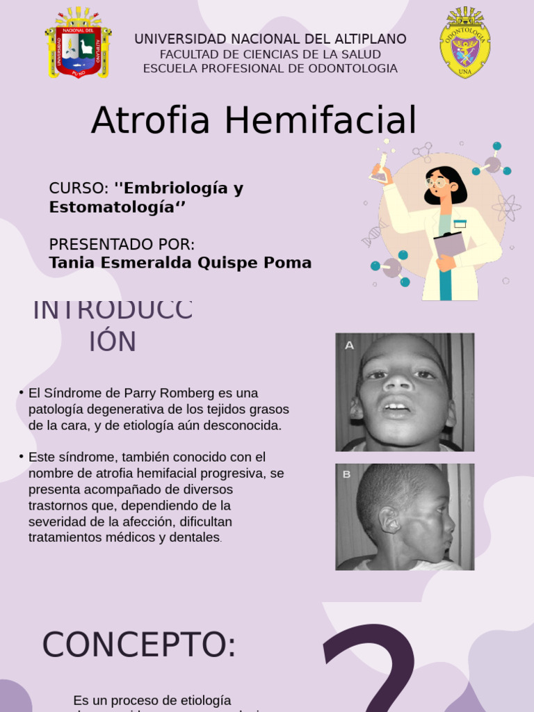 Atrofia Hemifacial Progresiva: Síndrome Romberg | PDF | Odontología ...