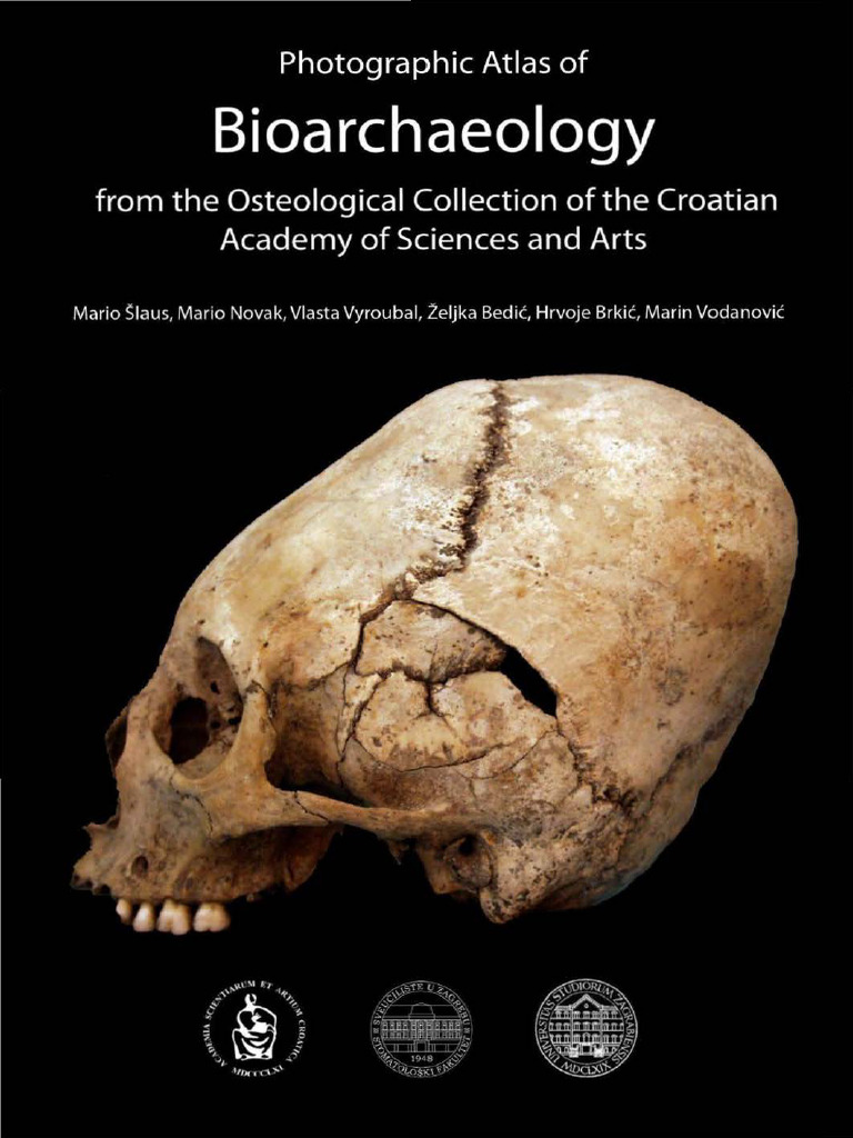 Photographic Atlas of Human Bioarchaeology From The - Mario Slaus ...