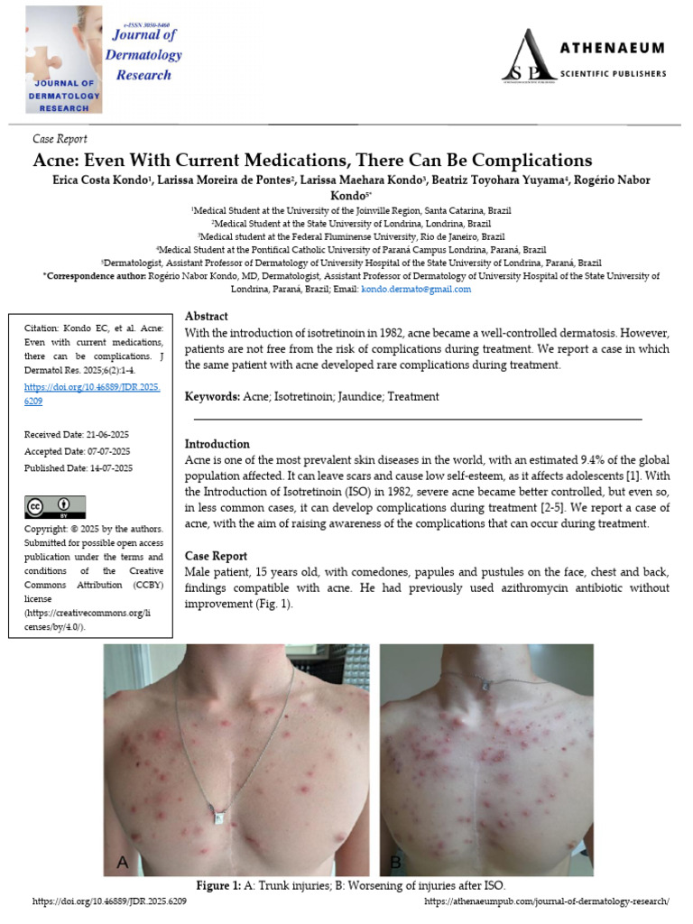 Acne Treatment Complications Explained | PDF | Medical Specialties ...