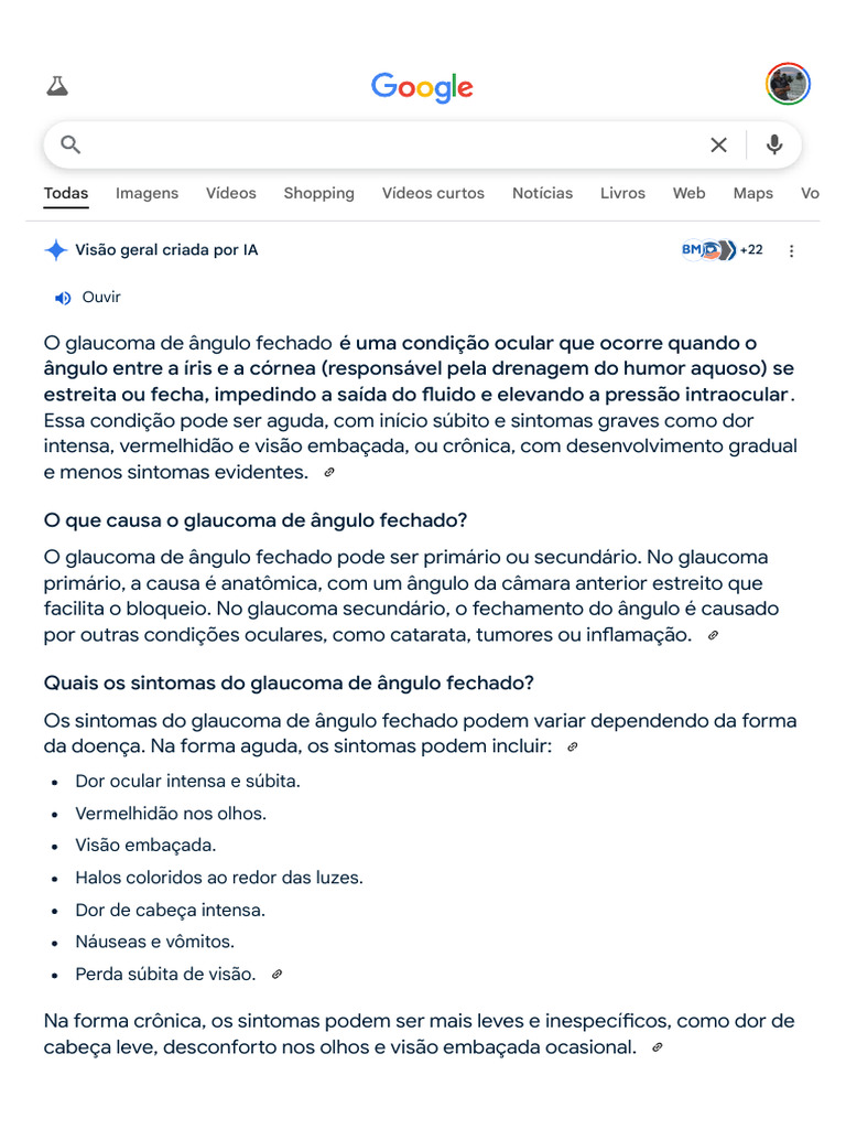 Glaucoma de Ângulo Fechado: Sintomas e Tratamento | PDF | Glaucoma ...